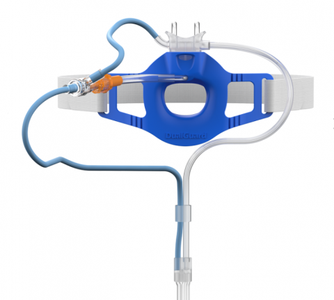 DualGuard™ - Capnography and CO2 Monitoring Cannula | trudellhs.com